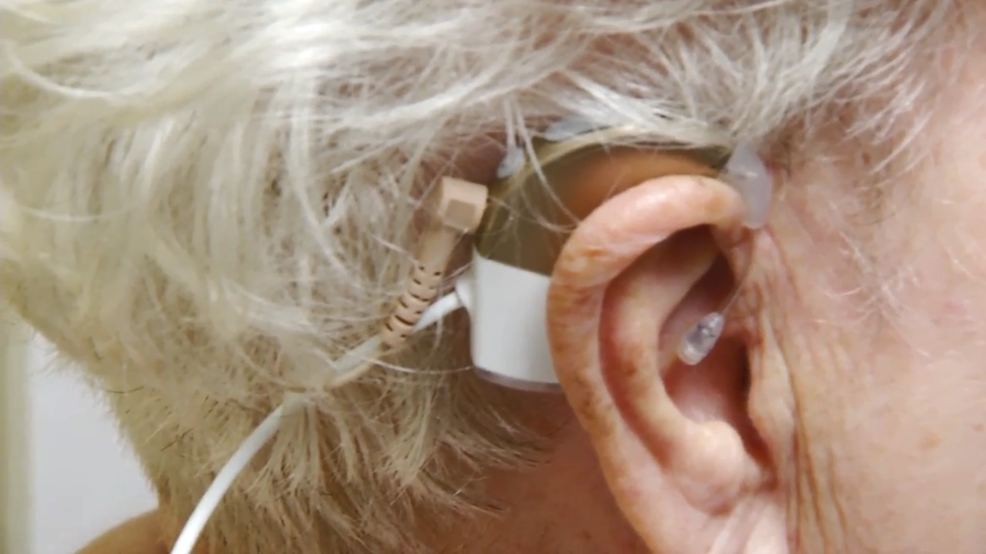 Woman receives cochlear implant, first in Northwest Florida | WEAR