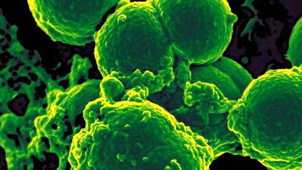 12 cases of MRSA reported at UPMC Children's Hospital NICU | WJAC