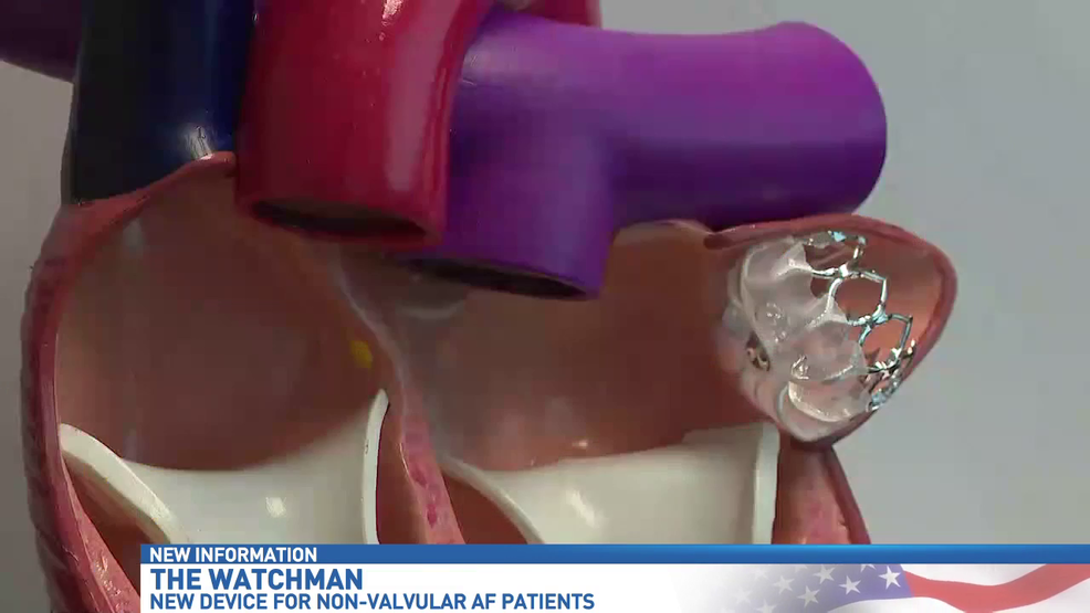 New device for non-valvular AFib patients available in Fort Walton ...
